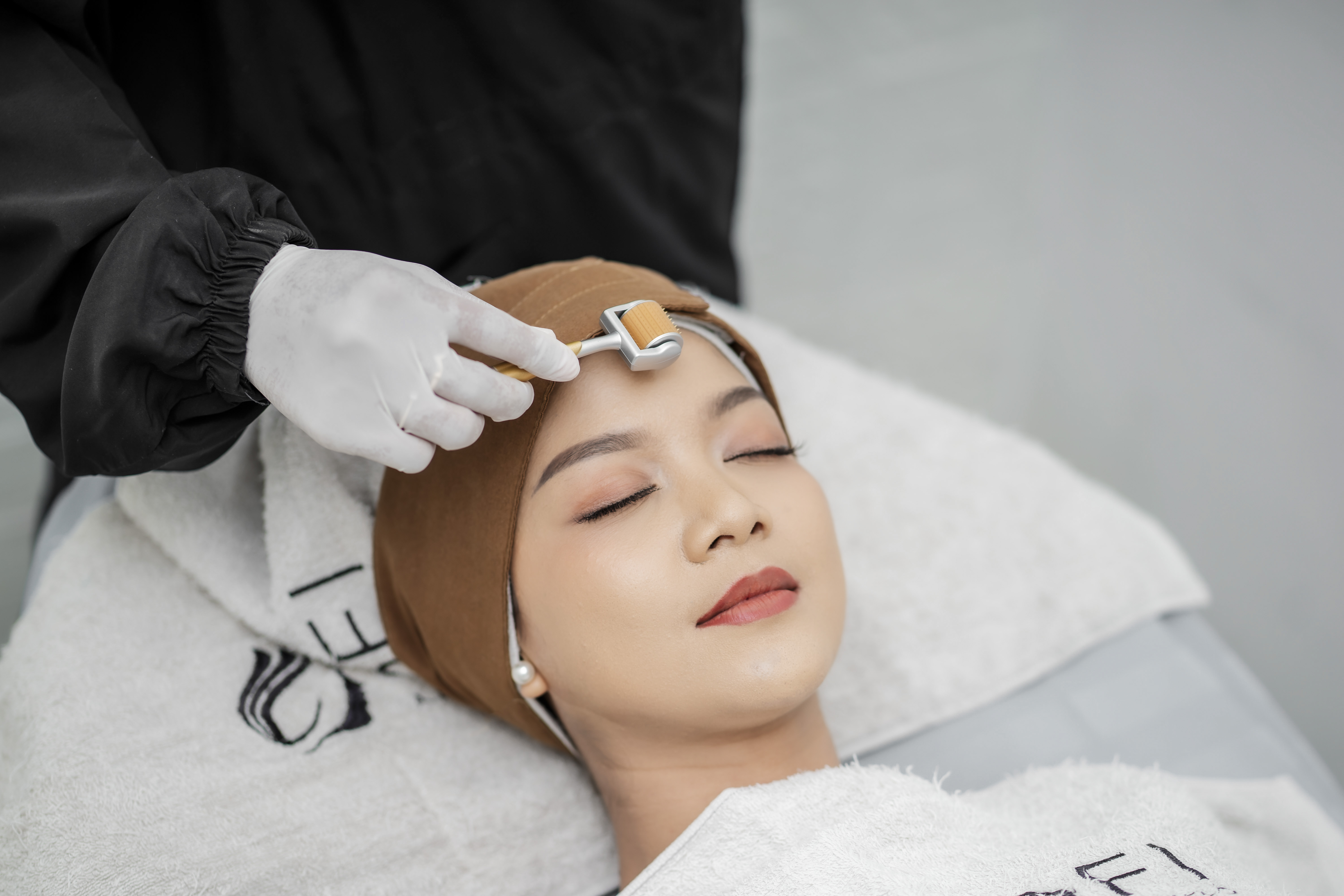 PRP Dermaroller - Shofi Aesthetic Clinic - Shofi Aesthetic Clinic